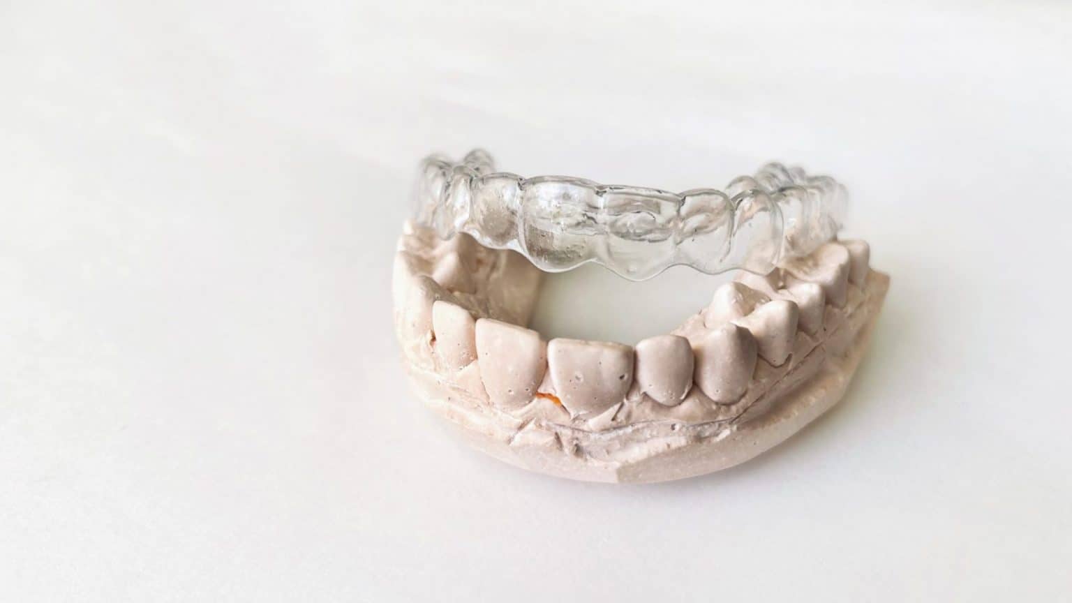 Mouth & Night Guards - Expat Dental